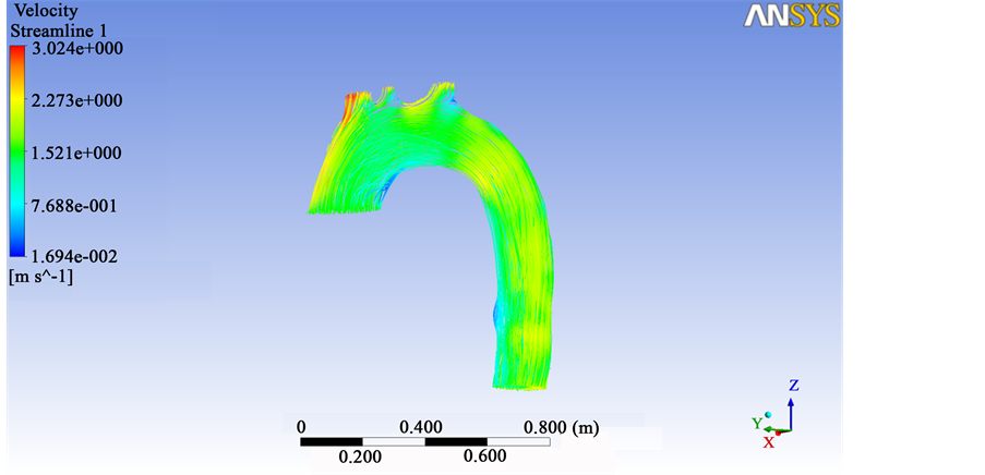 Computational Fluid Dynamics Analysis Of The Aortic Coarctation