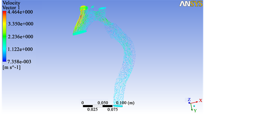 Computational Fluid Dynamics Analysis Of The Aortic Coarctation