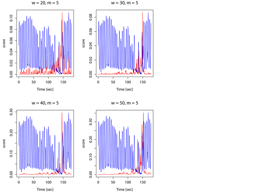 Automatic Anomaly Detection Of Respiratory Motion Based On Singular