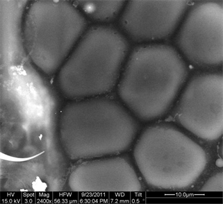 Scanning Electron Microscopy (SEM) of the Bug Eye and Sand Coral