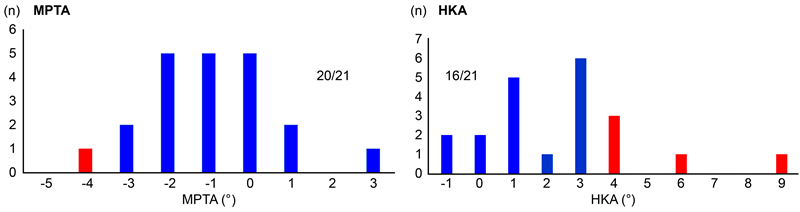 Kinematically Aligned Total Knee Arthroplasty for Valgus Osteoarthritis ...