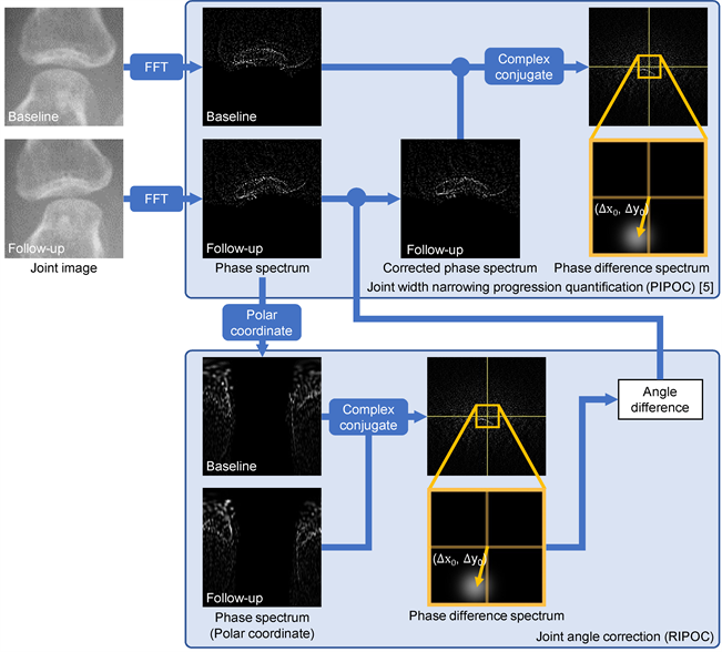 Joint Angle Correction in Rheumatoid Arthritis and Its Reliability ...
