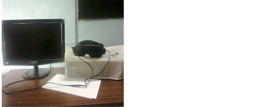 Role of Videonystagmography (VNG) in Epley’s Maneuver