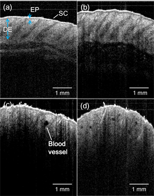 In Vivo Observation of Allergic Dermatitis of the Genuine Pig by ...