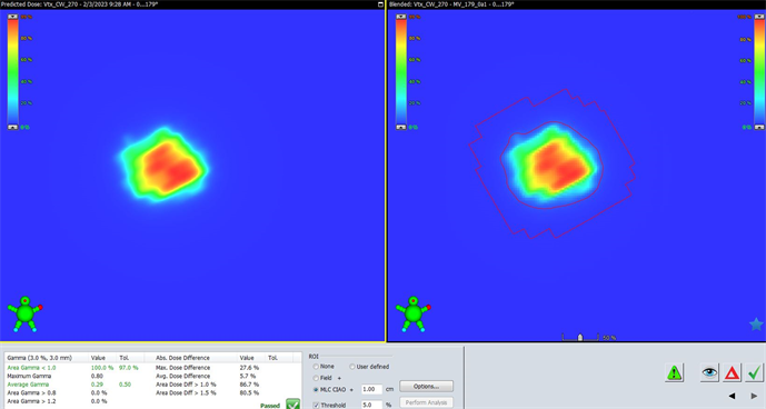 The Journey of SRS: An Initial Experience of Starting Sterotactic ...
