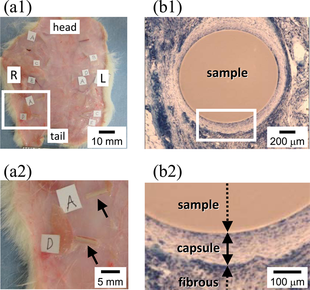 Surface Modification Of Peek And Its Osteoconductivity And Anti