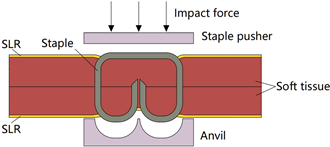 Simulation and Experimental Study of Staple Line Reinforcement Surgery
