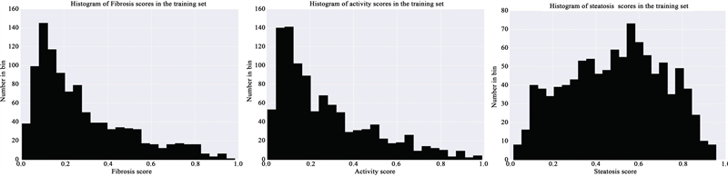 Machine Learning Technology for Evaluation of Liver Fibrosis ...