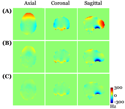 Comparison of FASTMAP and B0 Field Map Shimming at 4T: Magnetic Field ...