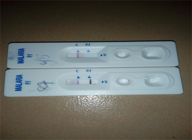 The Efficacy of Rapid Diagnostic Test in the Diagnosis of Malaria among ...