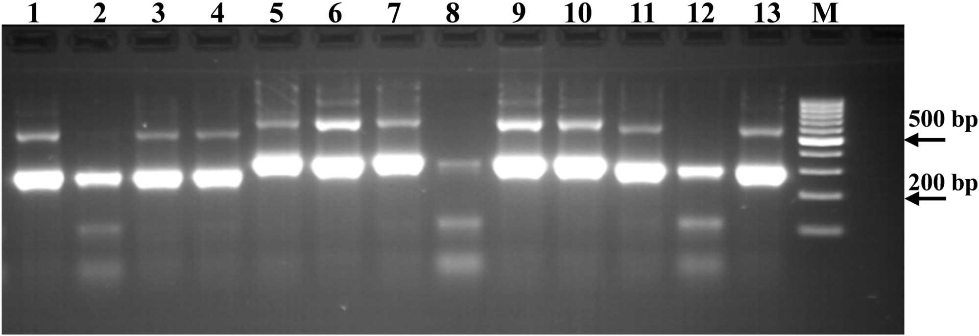 Molecular Identification of Echinococcus spp. and Other Taeniid ...
