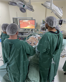 SADI-S with Extended Duodeno-Bulb Preservation: Case Report