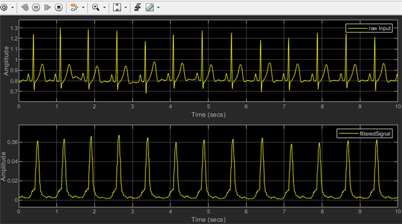 Fast QRS Complex Detection Algorithm Based on RMS Shifting Concept for ...