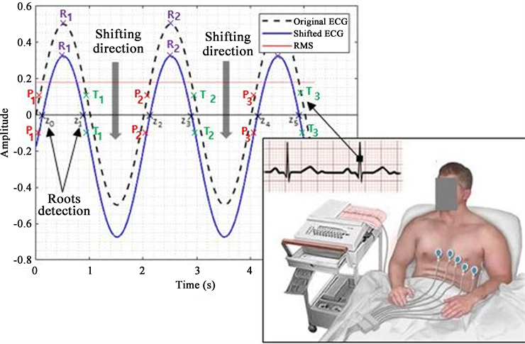Fast Qrs Complex Detection Algorithm Based On Rms Shifting Concept For Heart Rate Estimation