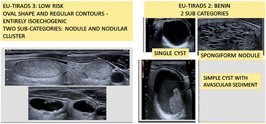 Clinical, Laboratory and Ultrasound Profile of Patients with Thyroid ...