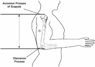 Association between Anthropometry and Gestational Diabetes Mellitus