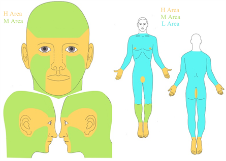 Mohs Micrographic Surgery Technique