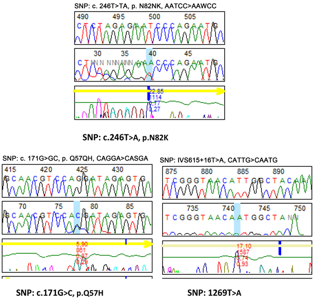 What Impact on Phenotype for Patients with Karyotype 46, XX DSD SRY ...