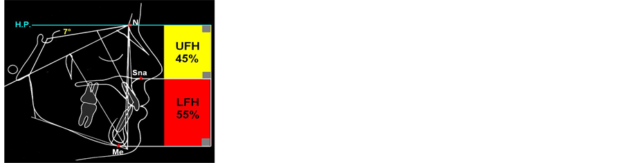 A Therapeutic Concept by “Watted” for the Surgical Lengthening of the ...