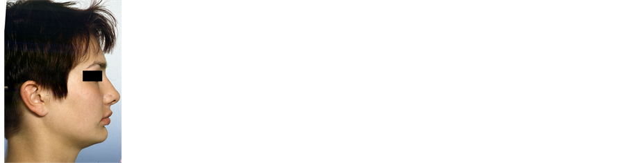 A Therapeutic Concept by “Watted” for the Surgical Lengthening of the ...