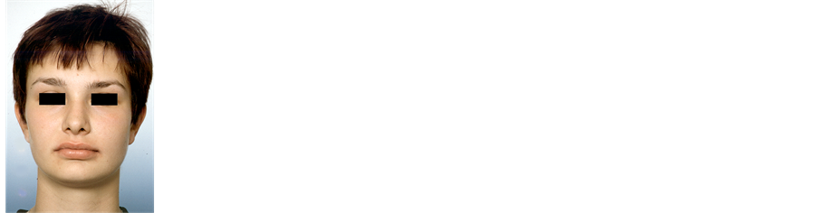 A Therapeutic Concept by “Watted” for the Surgical Lengthening of the ...