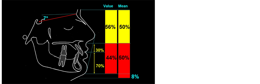 A Therapeutic Concept by “Watted” for the Surgical Lengthening of the ...