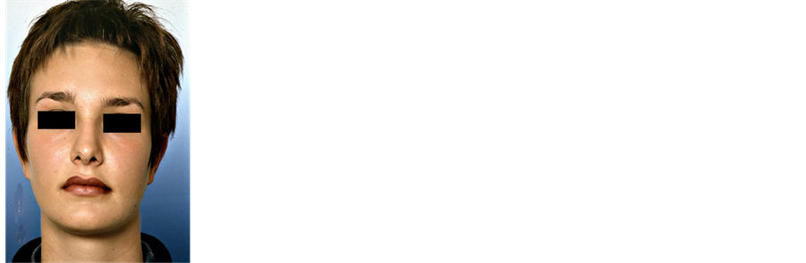 A Therapeutic Concept by “Watted” for the Surgical Lengthening of the ...