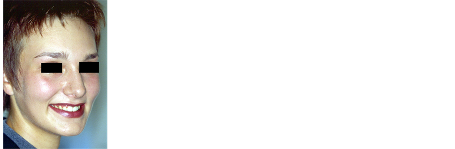 A Therapeutic Concept by “Watted” for the Surgical Lengthening of the ...