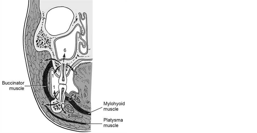 Severity Score as a Prognostic Factor for Management of Infections of ...