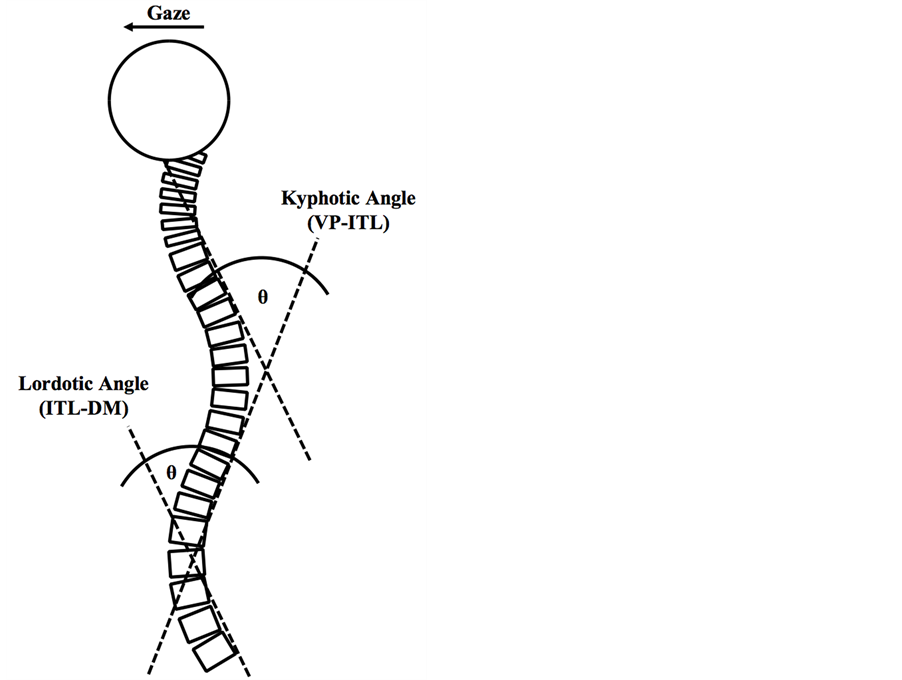 Comparison of Barefoot vs. Shod Gait on Spinal Dynamics Using DIERS ...