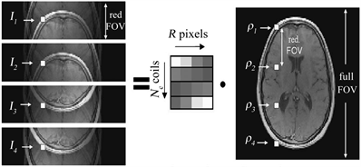 Application of Sensitivity Encoding Reconstruction for MRI with BOLD Signal
