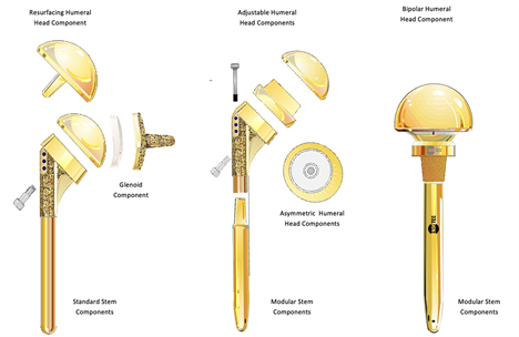 Buechel Pappas Resurfacing Shoulder Replacement: Evolution and over 40 ...