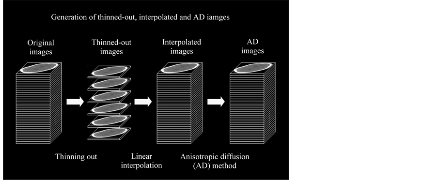 Usefulness of an Anisotropic Diffusion Method in Cerebral CT Perfusion ...