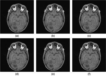 Application of Sparse-Coding Super-Resolution to 16-Bit DICOM Images for Improving the Image ...