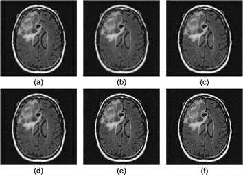 Application of Sparse-Coding Super-Resolution to 16-Bit DICOM Images for Improving the Image ...
