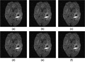 Application of Sparse-Coding Super-Resolution to 16-Bit DICOM Images for Improving the Image ...