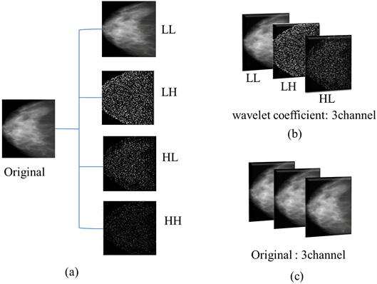 Using A Wavelet Based And Fine Tuned Convolutional Neural Network For Classification Of Breast