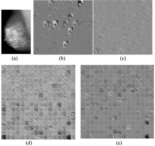Using A Wavelet Based And Fine Tuned Convolutional Neural Network For Classification Of Breast
