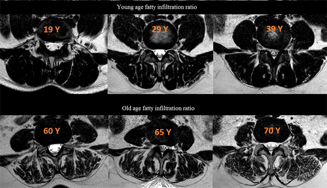 Quantification Threshold Pixel Technique of Magnetic Resonance Imaging ...
