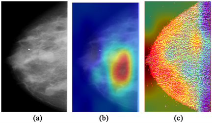 A Breast Density Classification System for Mammography Considering ...