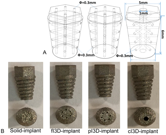 Preventing Implant Bacterial Infections with Interconnected 3D Porous ...