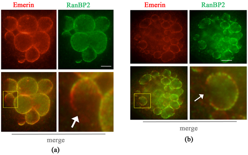 Three Types of Nuclear Envelope Assemblies Associated with Micronuclei