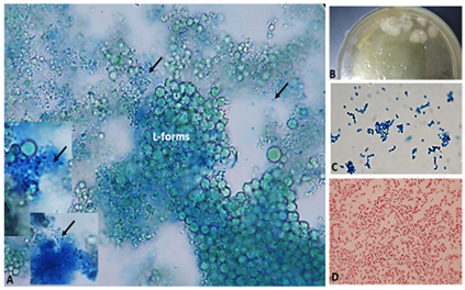 Novel Approach to Microbiological Study of Chronic Inflammations at ...