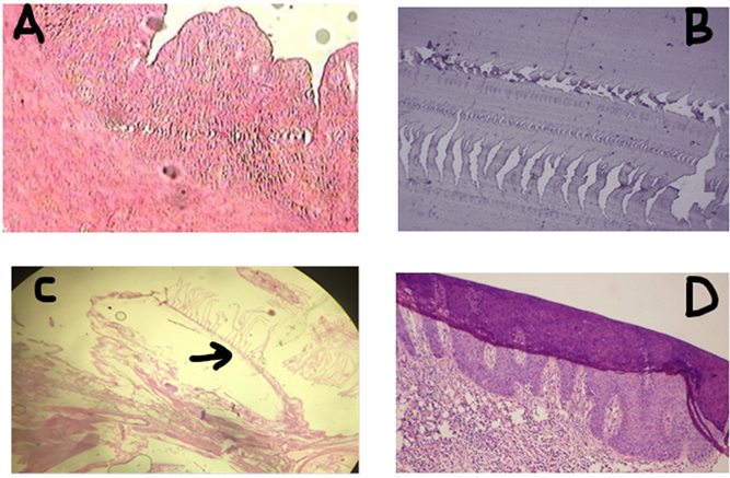 Common Artifacts And Remedies In Histological Preparations