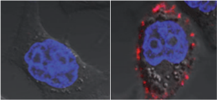 Gold Standard for Skin Cancer Treatment: Surgery (Mohs) or Microscopic ...