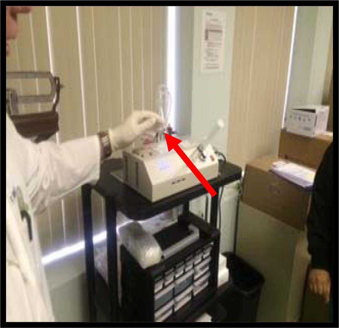 Ozone Injections in Orthopaedics: An Effective Substitute for Cortisone ...