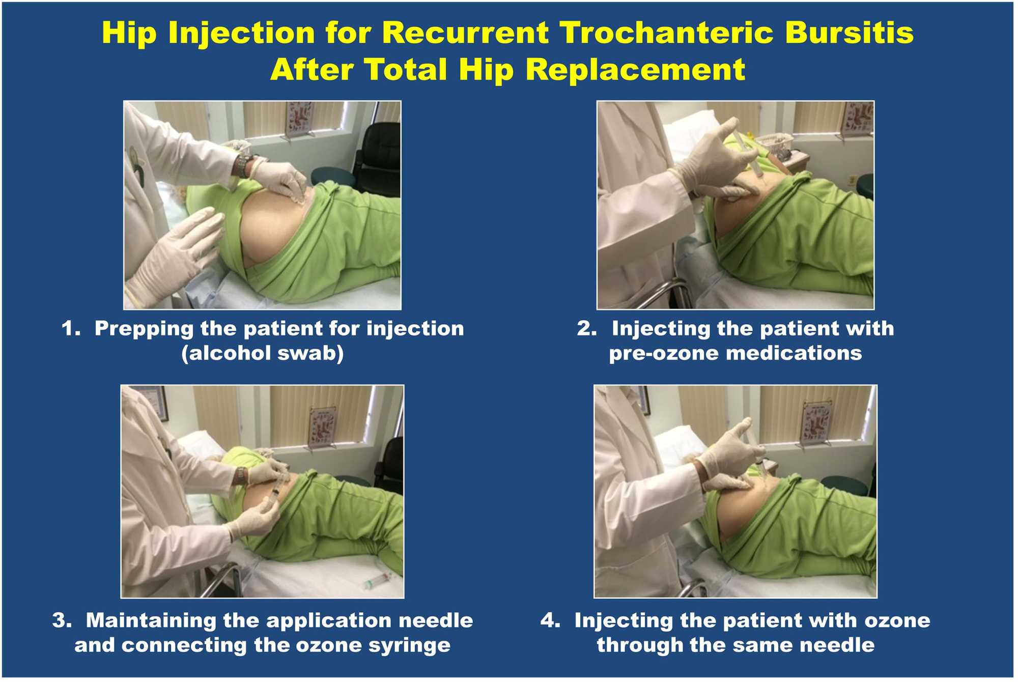 Ozone Injections in Orthopaedics: An Effective Substitute for Cortisone ...