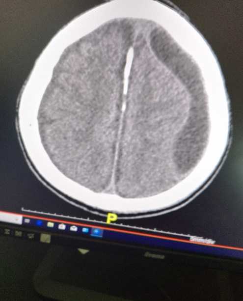 Contribution of Computed Tomography in the Diagnosis of ...