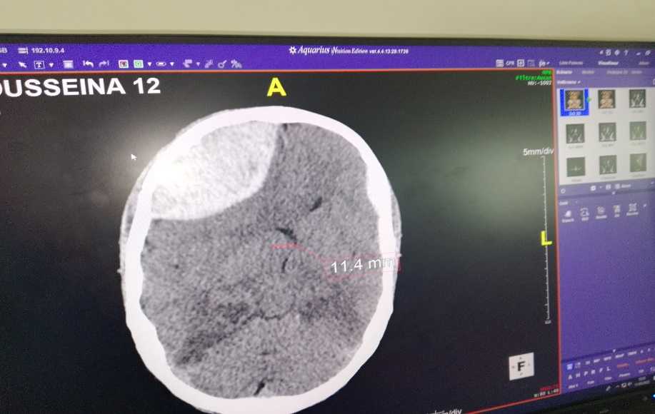 Contribution of Computed Tomography in the Diagnosis of ...