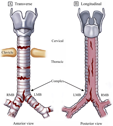 Emergency Treatment and Nursing Care of a Patient with Multiple ...